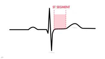 The Cardiac Cycle (P-QRS-T) | Nucleotype