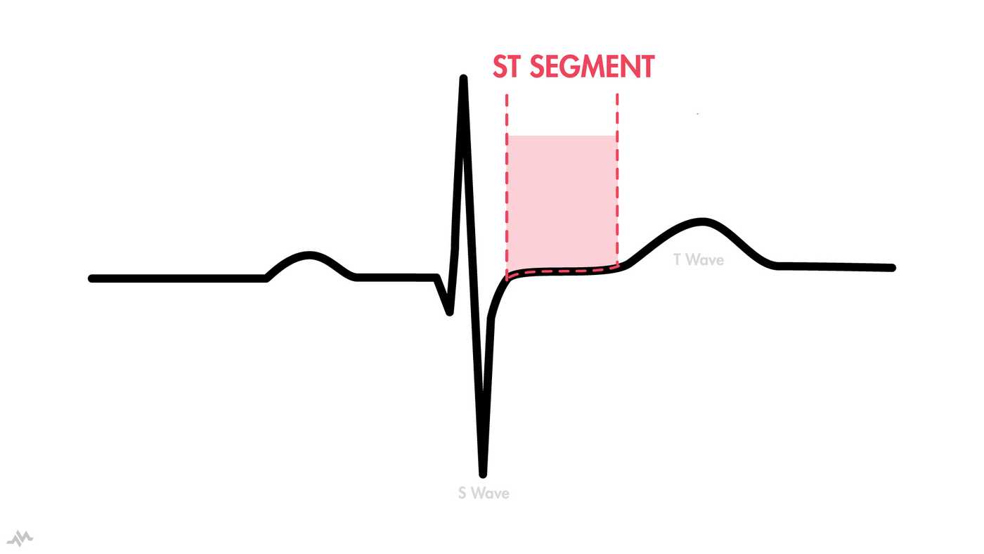 The Cardiac Cycle (P-QRS-T) | Nucleotype