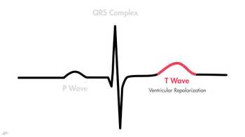The Cardiac Cycle (P-QRS-T) | Nucleotype